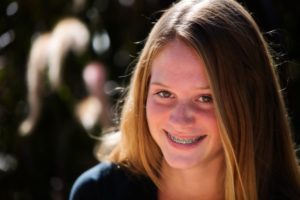 Metal Braces Offered at Shanahan Orthodontics | Napa Orthodontist